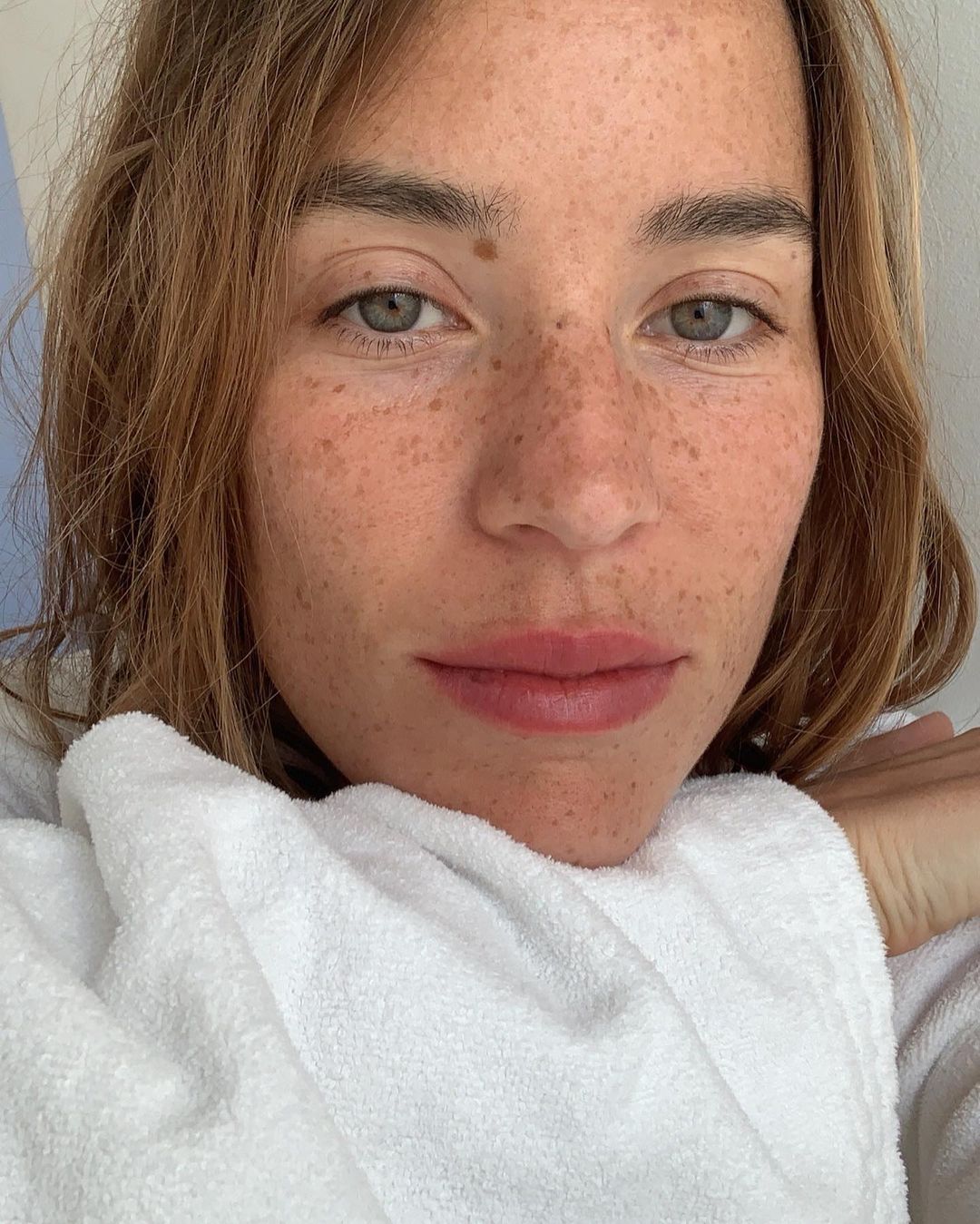 Piel con pecas: cómo cuidarla adecuadamente y protegerla del sol