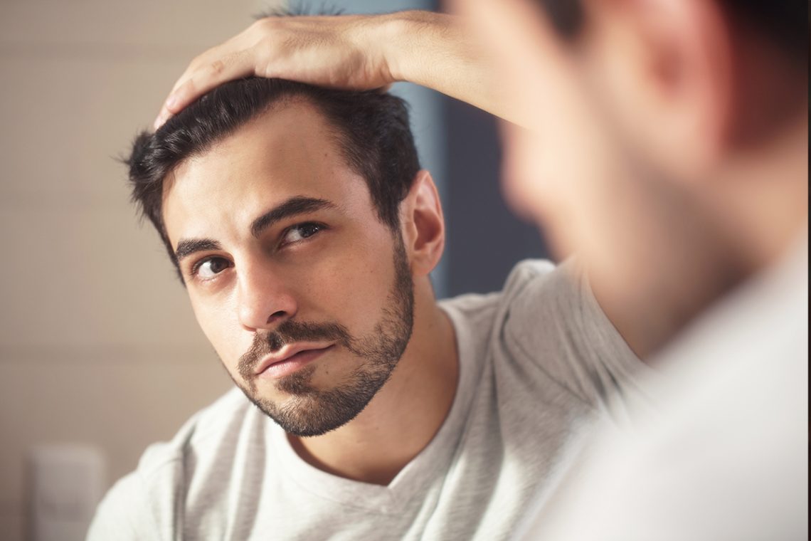 5 cortes de pelo para hombres con entradas modernos