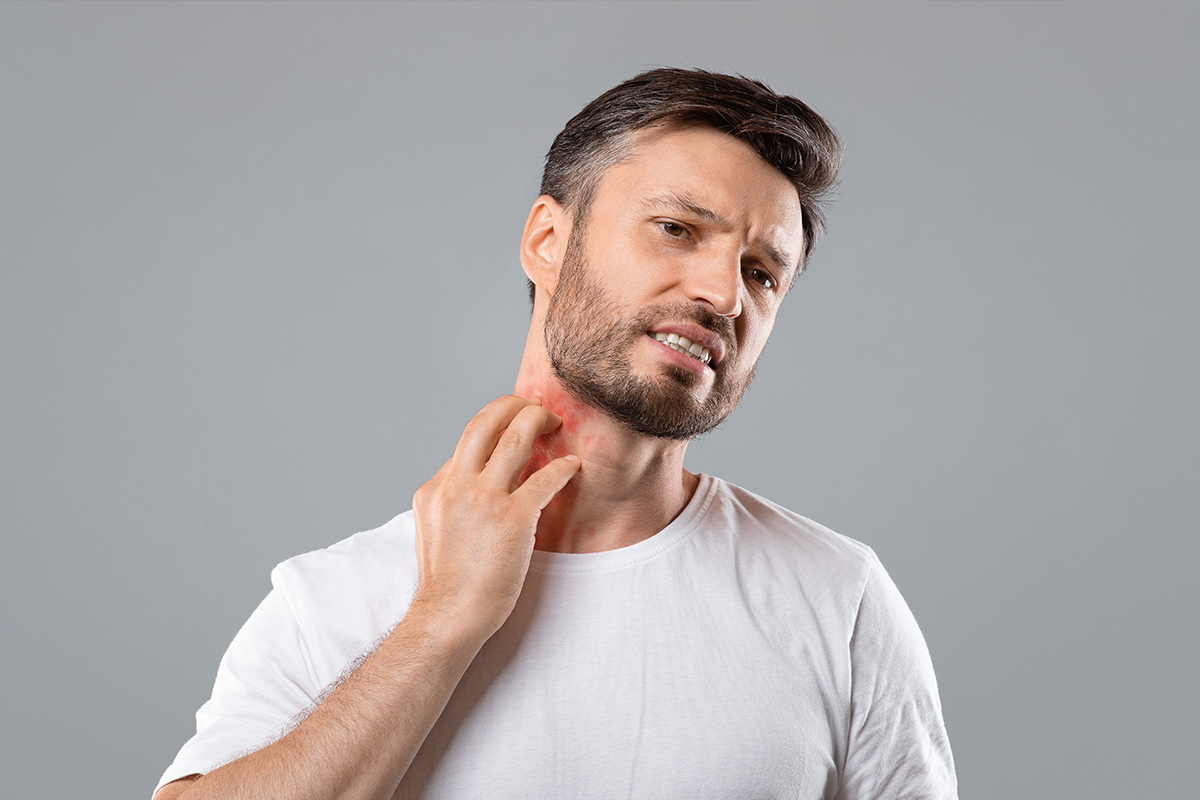 Sarpullido en el cuello: las posibles causas y las mejores soluciones