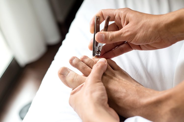 Uñeros: qué son, por qué salen y cómo curarlos