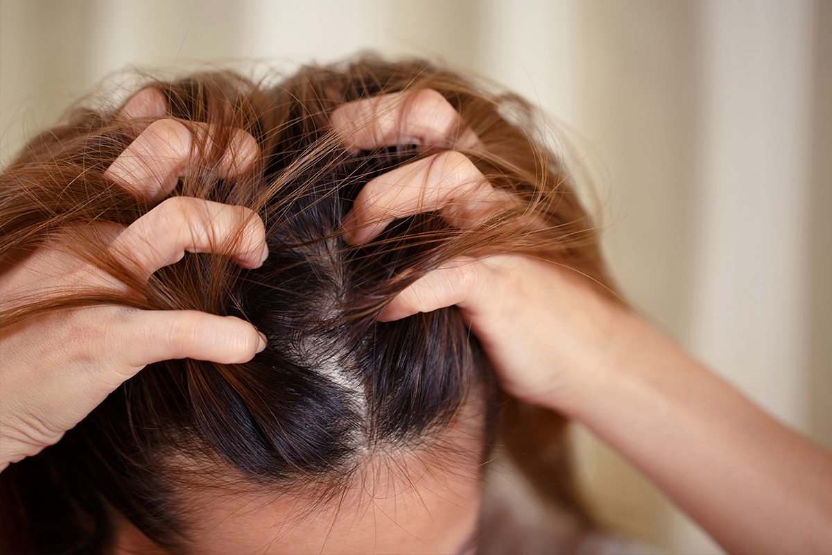 Las principales diferencias entre la caspa grasa y la caspa seca