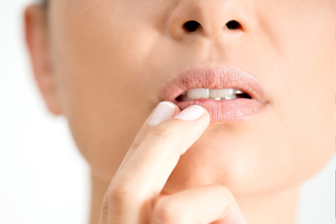 Llagas dentro de la boca: por qué salen y cómo debes curarlas