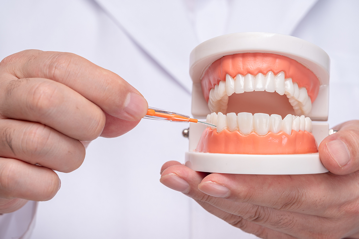 Las 6 mejores alternativas al hilo dental