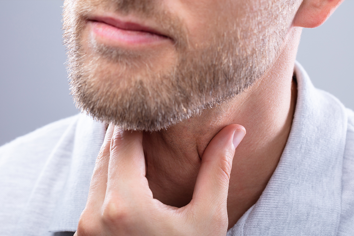 Cómo tratar la dermatitis seborreica en la barba