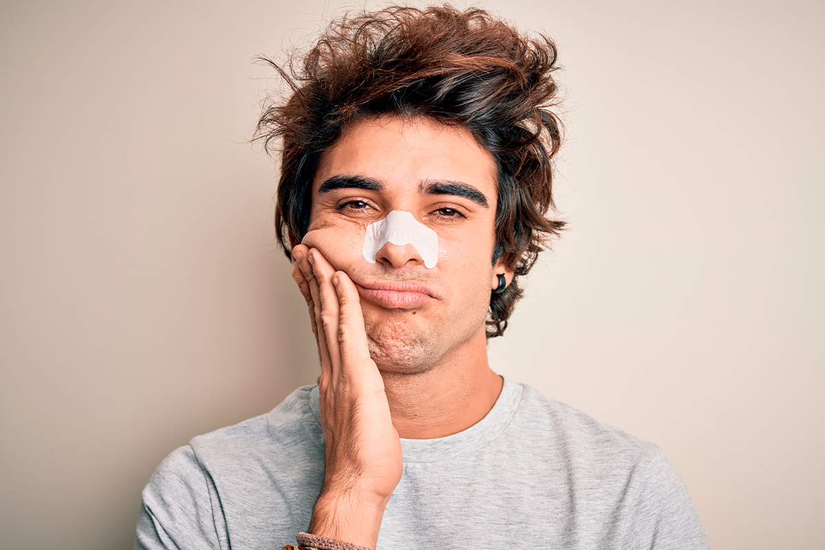 Por qué tengo exceso de sebo en la cara